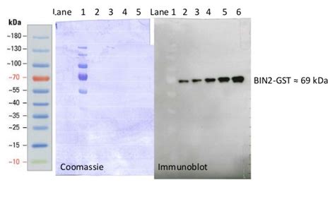 Bin2 Brassinosteroid Insensitive 2