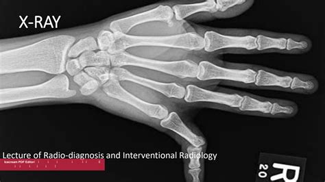 Solution Introduction To Xray And Floroscopy Studypool