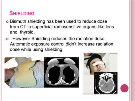 Ct Radiation Dose Reduction Pptx Digital Audio Computer Software And Applications