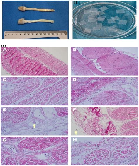 Decellularization Of Various Tissues And Organs Through Chemical