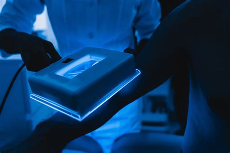 Testing For Vitiligo Getting A Vitiligo Diagnosis