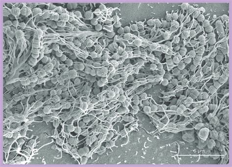 Electron Microscope Image Demonstrating The Attachment Of Streptococcus