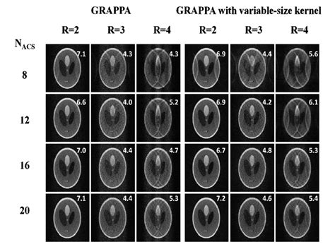 The Reconstructed Sum Of Squares Images Using Grappa And Variable Size Download Scientific