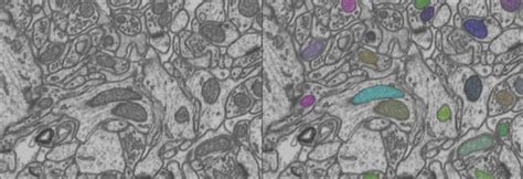 Apeer Blog What To Expect With Small Training Datasets For Instance Segmentation