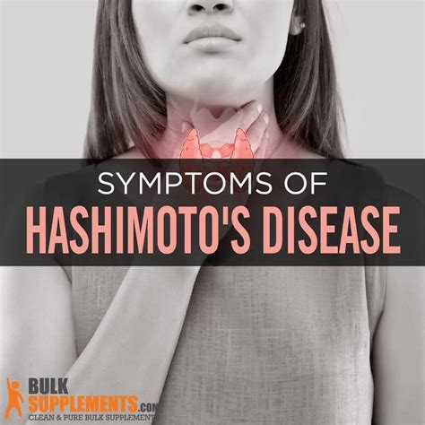 Hashimoto S Disease Symptoms Causes Treatment