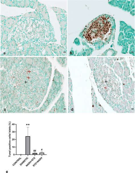 Effect Of Prior And Post Treatment With Nadh On Pancreatic Beta Cell