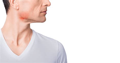 What Causes Shaving Rash And How To Prevent It Schick What Causes Shaving Rash And How To Prevent It Schick