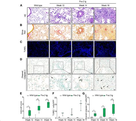 Time Line Of Apoptosis In The Fos Related Antigen 2 Fra 2 Transgenic Download Scientific