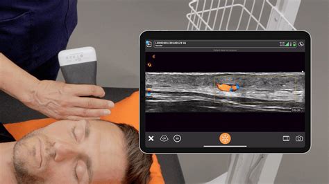 Temporal Artery Evaluation Clarius