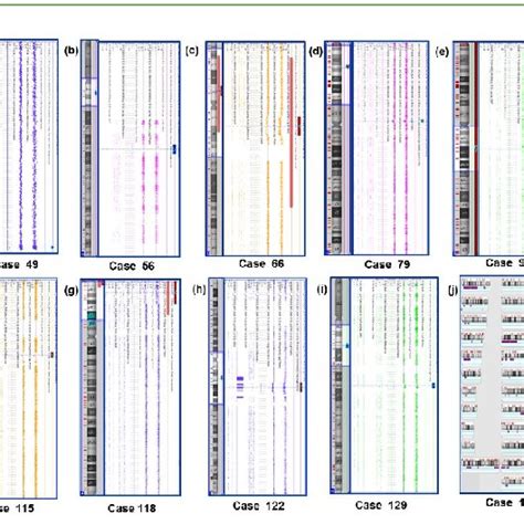 Pathogenic Genomic Imbalances Cytoscan 750k Microarray Profile A To Download Scientific