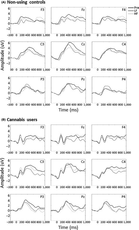 A Amplitude And B Latency Of The P2 Component In Response To