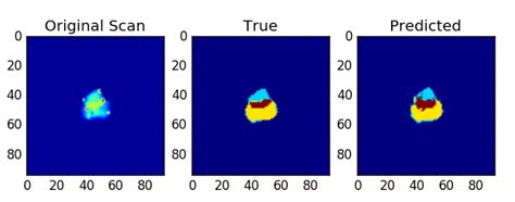 Segmenting Overlapping Chromosomes Using Deep Learning · Iota