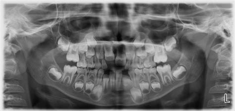 Yildiz Teknik Roboflow Universe