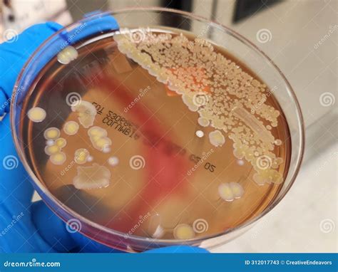 Acinetobacter Hemolytic Bacterial Colonies On Agar Plate Stock Image