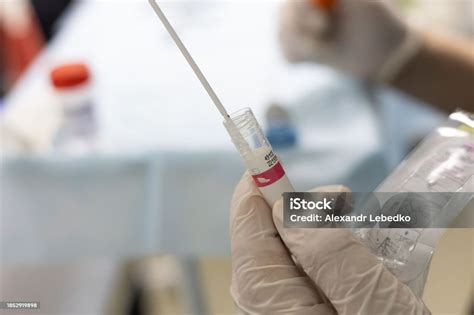 The Doctor Removes A Piece Of Tissue From The Endoscopic Biopsy Forceps