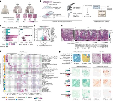 What Spatial Transcriptomics Is And Why We Should Care Daniel