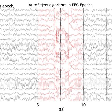 figure a1 ica templates used for eog artifact removal from eeg on the download scientific
