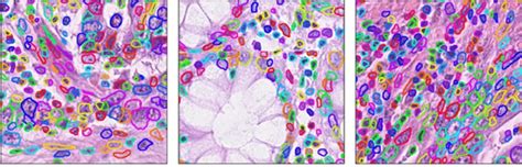 Sample Of Cropped Regions From Consep Dataset Download Scientific Diagram