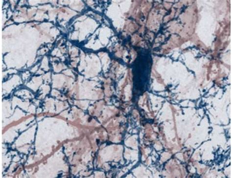 Inflammatory Reactions In Multiple Sclerosis Lead To Synapse Loss In