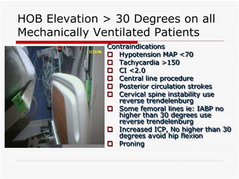 Ppt Ventilator Associated Injuriescomplications And Infections