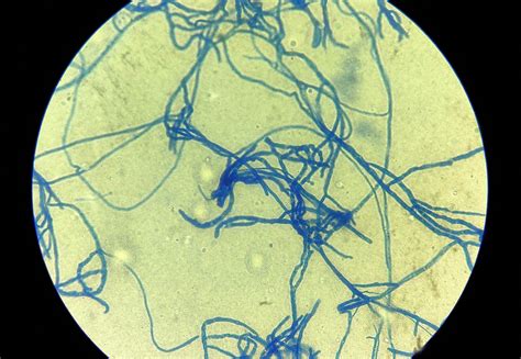 Microsporum Spp Laboratorio Veterinario Patvetec
