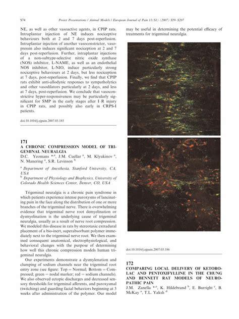 Pdf 171 A Chronic Compression Model Of Trigeminal Neuralgia Dokumen