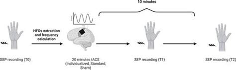Alessandro Cruciani On Linkedin High Frequency Transcranial Alternating Current Stimulation