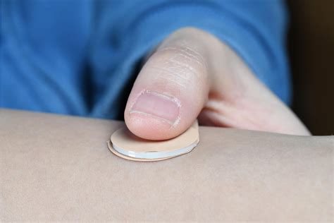 Birth Control Patch This New Contraceptive Skin Patch Is A Gamechanger