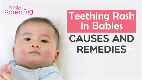 Teething Rash Face Pictures Teething Rash On Face Tee