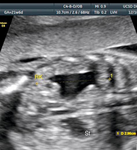 Fetal Urogenital Imaging Clinical Tree