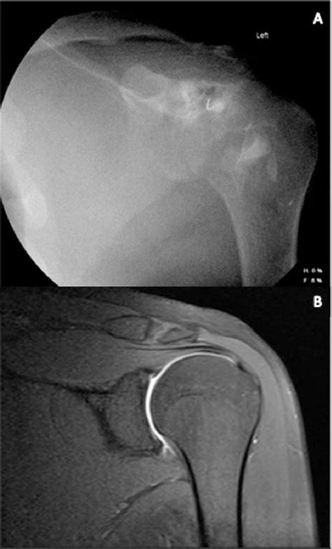 Figure 1 From Comparison Of Radiation Doses Of Various Approaches Of Mr