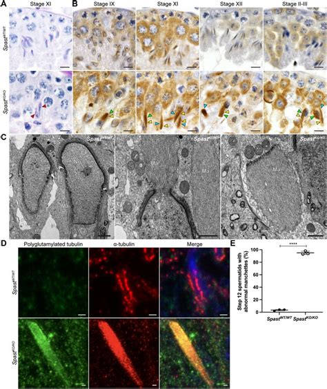 Spastin Is A Key Regulator Of Manchette Structure And Dynamics A Download Scientific Diagram