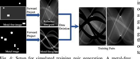 Figure 1 From Fast Enhanced Ct Metal Artifact Reduction Using Data Domain Deep Learning
