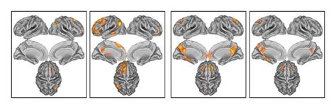 The Rsfc Patterns Of The Cerebellar Subregions In Healthy Controls And