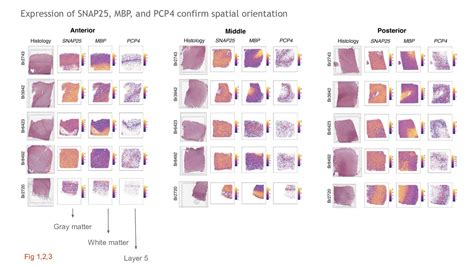 Integrated Single Cell And Unsupervised Spatial Transcriptomic Analysis Defines Molecular