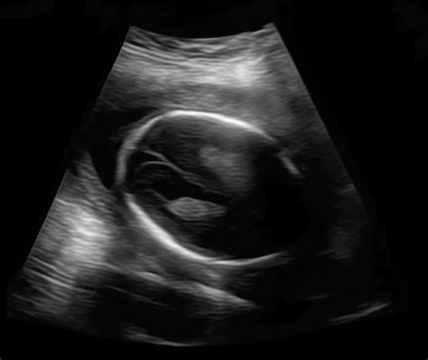 Importing Image From Array And Axis Reorder Beginner Questions Itk