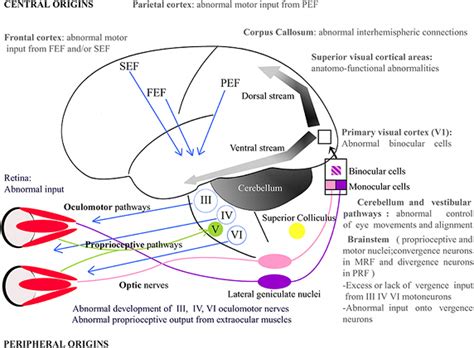 The Visual Pathways Roadmaps And Impacts Following Brain Injury