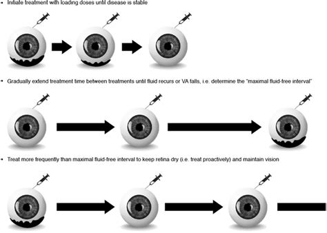 illustrative example of how a treat and extend regimen might be download scientific diagram