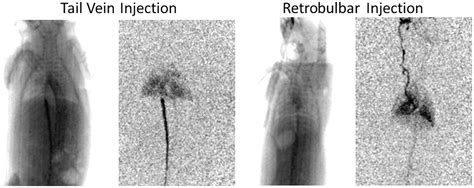 Retrobulbar Injection