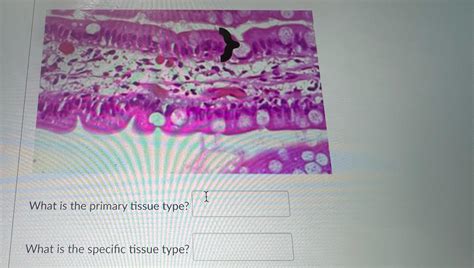 Solved What Is The Primary Tissue Typewhat Is The Specific