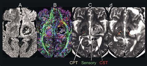 Diffusion Tensor Imaging Using A Spin Echo Stejskal Á Tanner Sequence Download Scientific