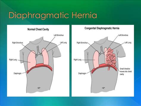 Ppt Pediatric Nursing Care Powerpoint Presentation Free Download