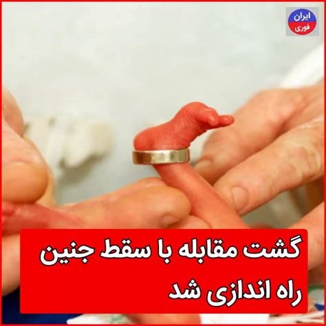 ‎تابلو اعلان قیمت دلار‎ ‎ ️گشت مقابله با سقط جنین راه اندازی شد 🔹