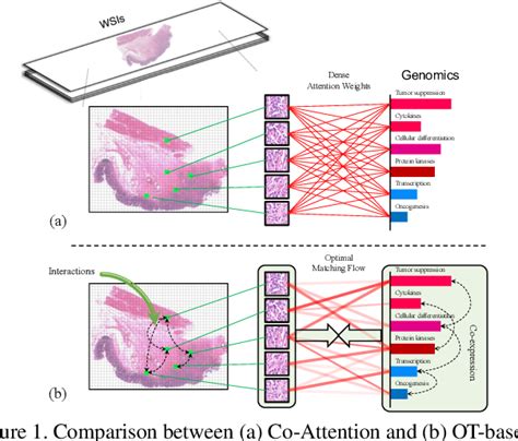Multimodal Optimal Transport Based Co Attention Transformer With Global
