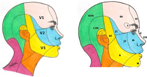 Diagnosis And Treatment Of Trigeminal Neuralgia Consensus Statement From The Spanish Society Of