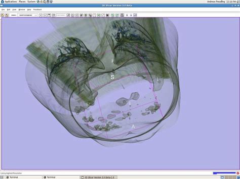 2008 Winter Project Week Volumerendering Namic Wiki