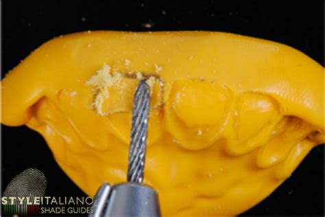 Brb Matrix A Simple Way To Produce Lingual Matrix