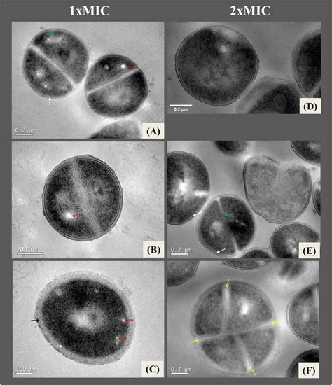 Frontiers Effect Of Nanoemulsion Loaded With Macela Achyrocline