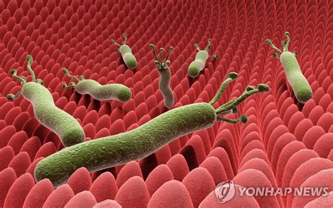 위암 수술 후 헬리코박터균까지 없애야 생존율 높아져 연합뉴스