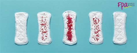 Nexplanon And Bleeding Long After Fpa Womens Health